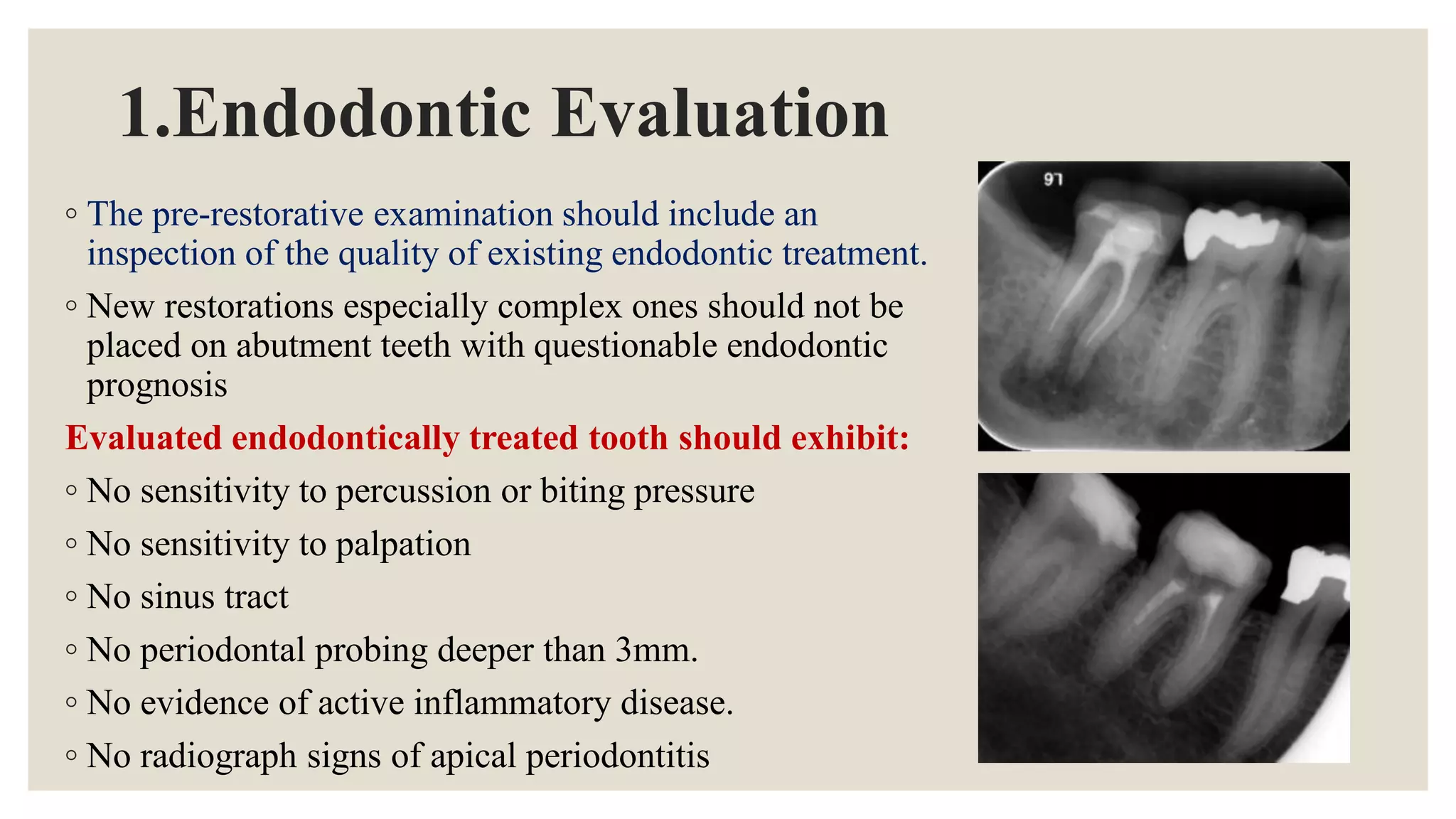 Restoration of endodontically treated teeth | PDF