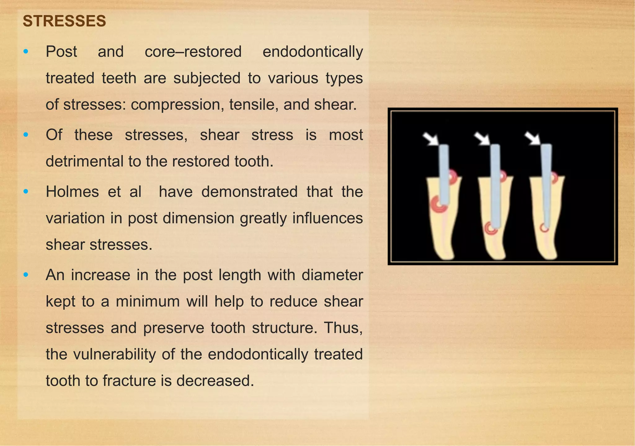 Restoration of endodontically treated teeth | PPT