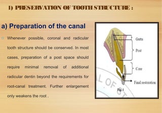 Restoration of endodontically treated teeth. | PPT