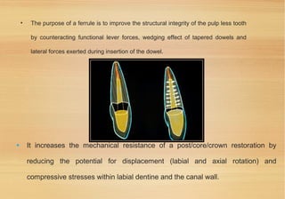 Restoration of endodontically treated teeth. | PPT