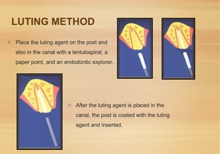 Restoration of endodontically treated teeth. | PPT