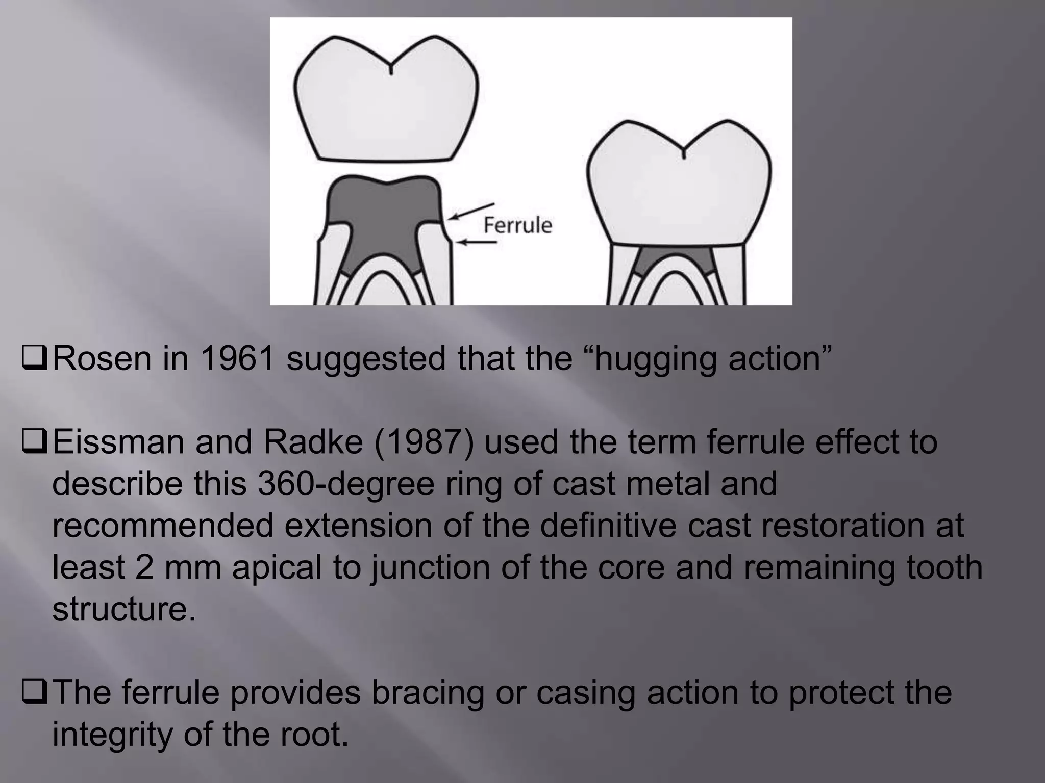 Prosthetic restoration of endodontically treated tooth | PPTX