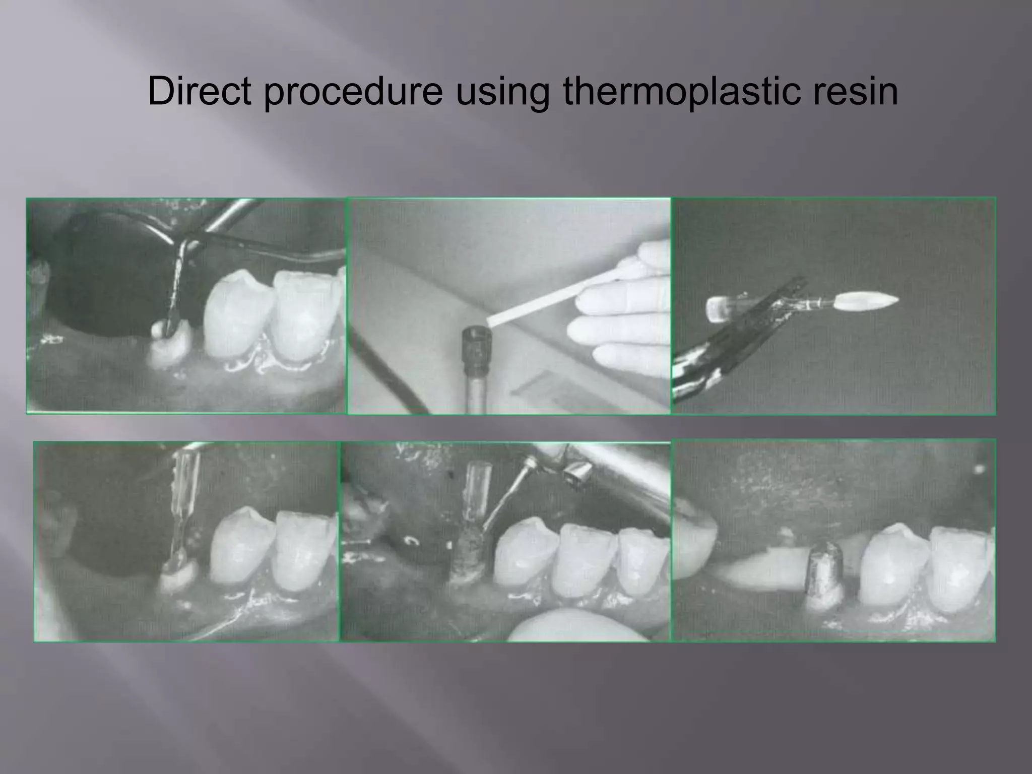 Prosthetic restoration of endodontically treated tooth | PPTX