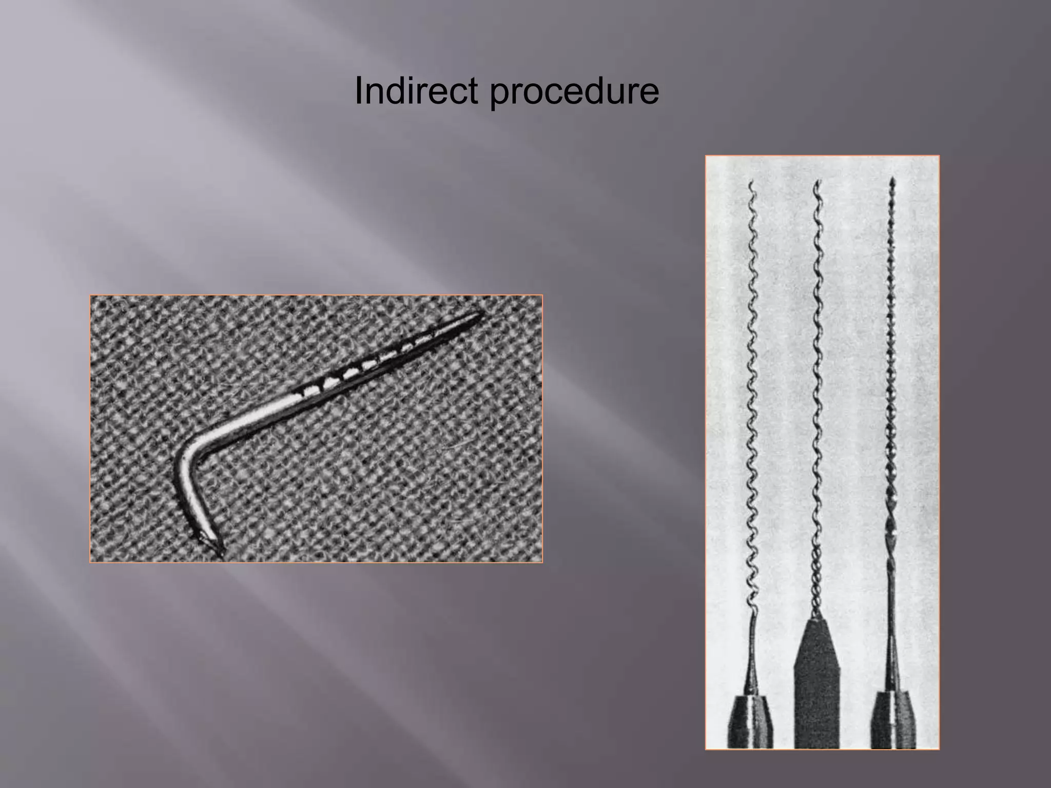 Prosthetic restoration of endodontically treated tooth | PPTX