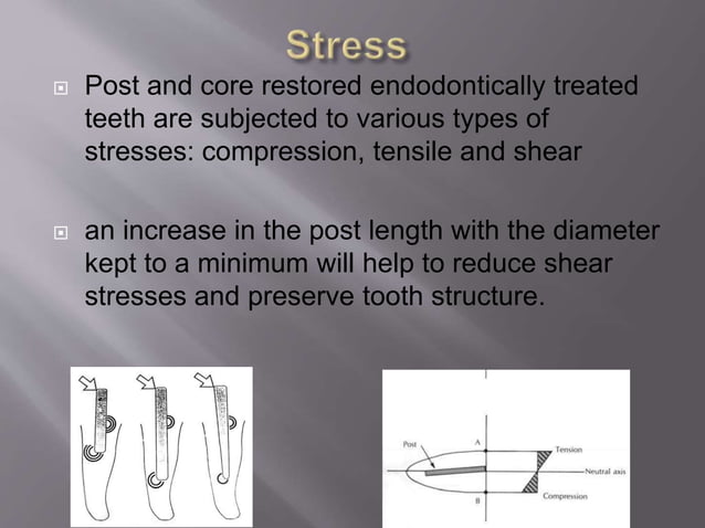 Prosthetic restoration of endodontically treated tooth | PPTX | Dental ...