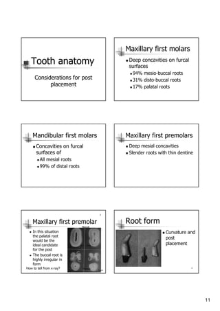 Restoration of enododontically treated teeth | PDF | Free Download