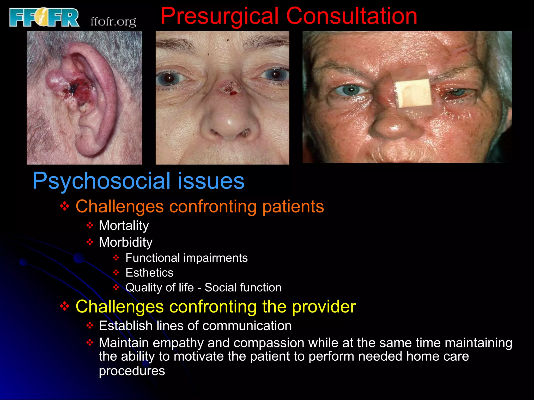 Restoration of facial defects basic priniciples | PPT