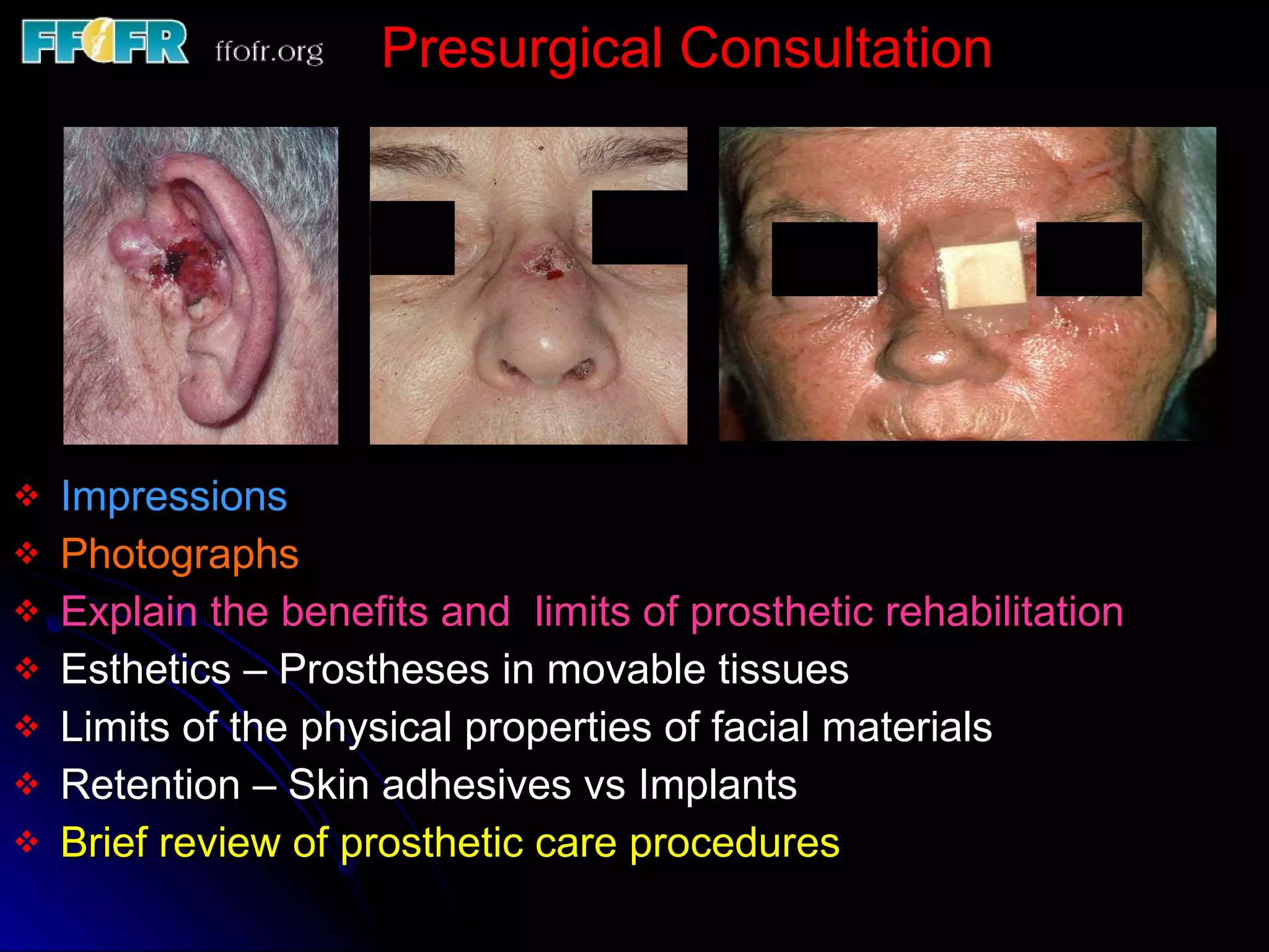 Restoration of facial defects basic priniciples | PPT