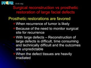 Restoration of facial defects basic priniciples | PPT