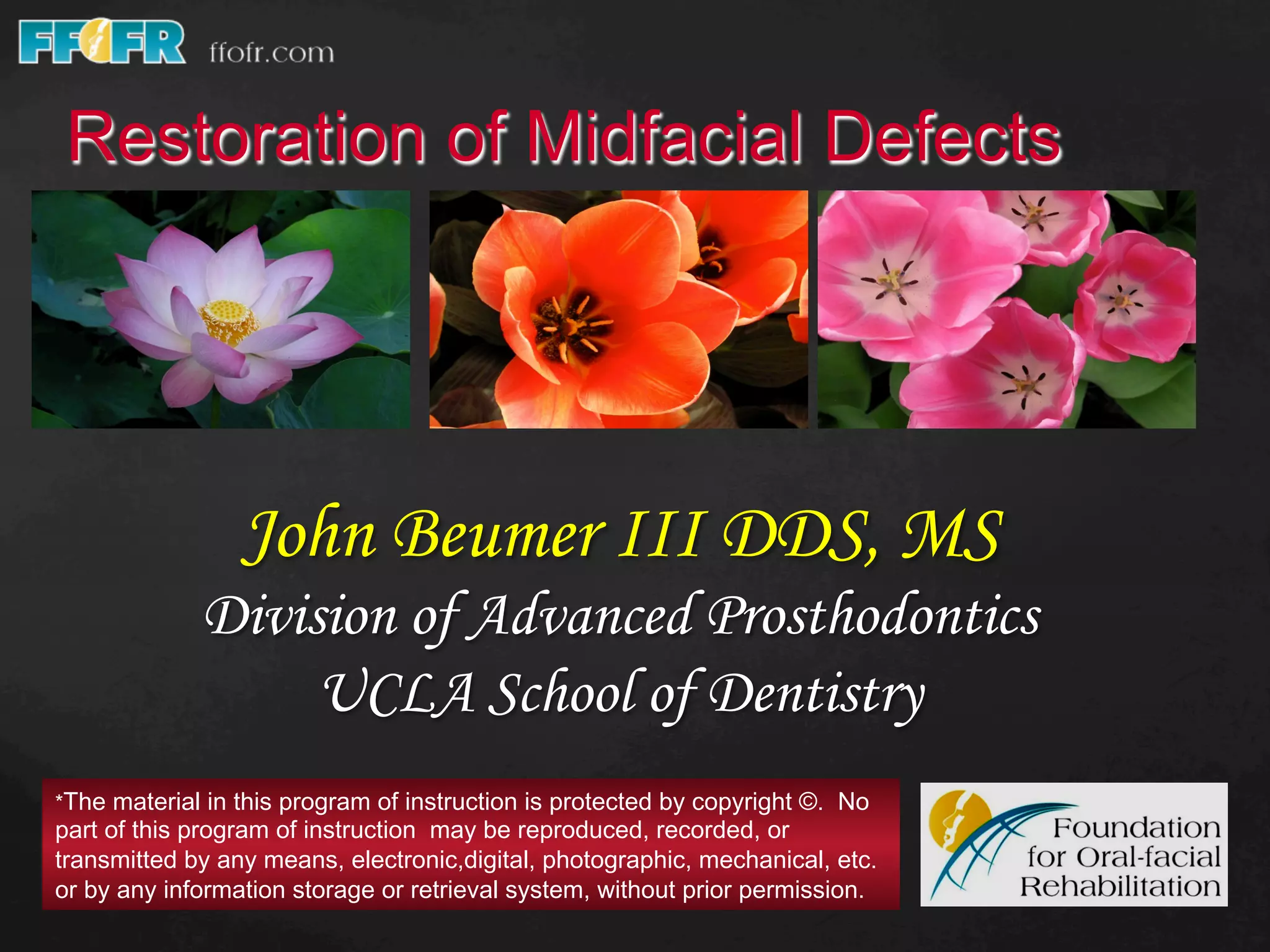 Restoration of midfacial defects | PDF