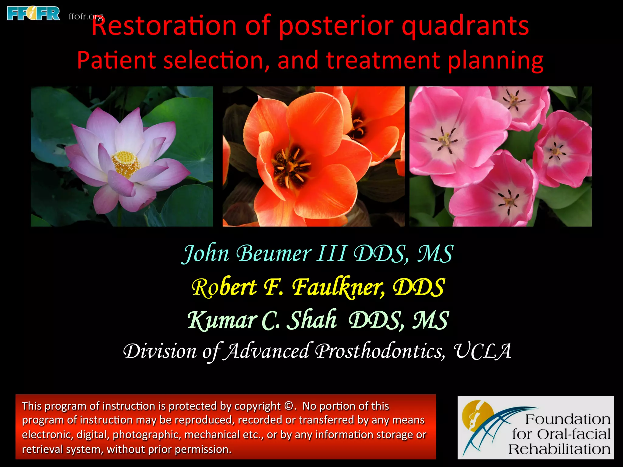 Restoration of posterior quadrants | PDF