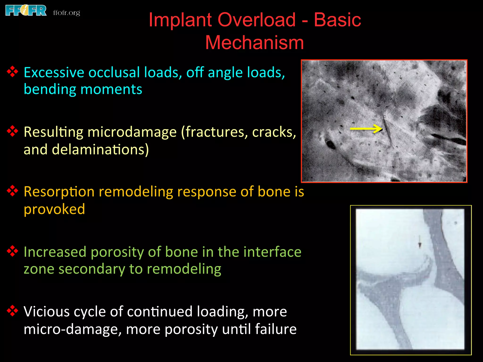 Restoration of posterior quadrants | PDF
