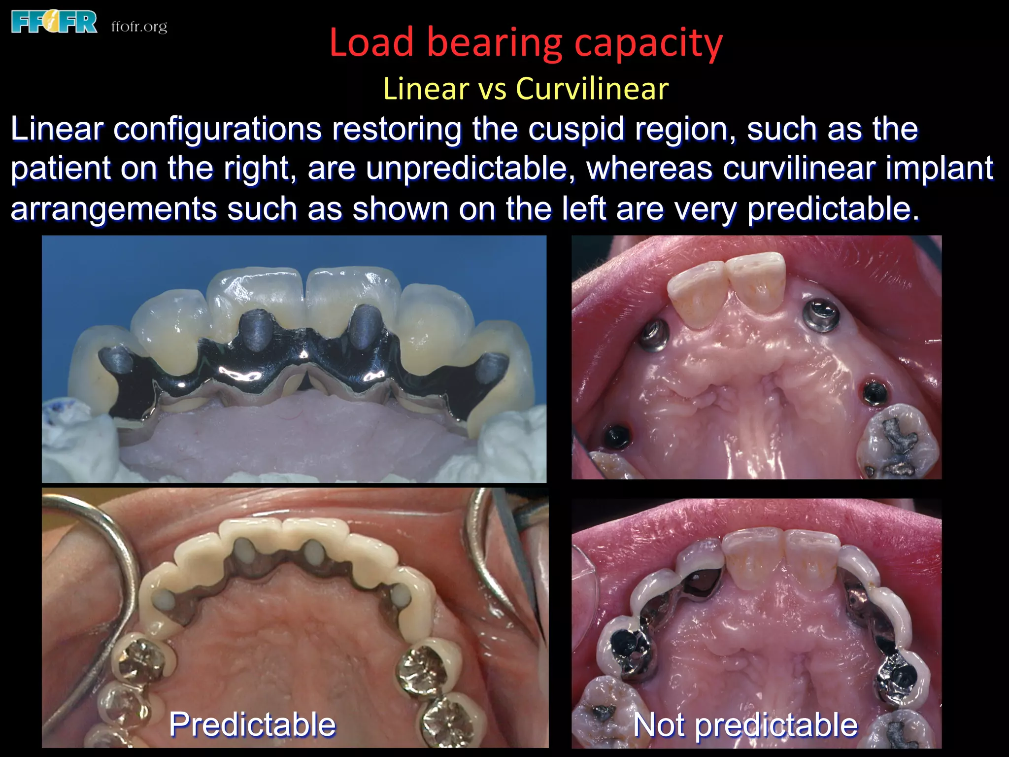 Restoration of posterior quadrants | PDF