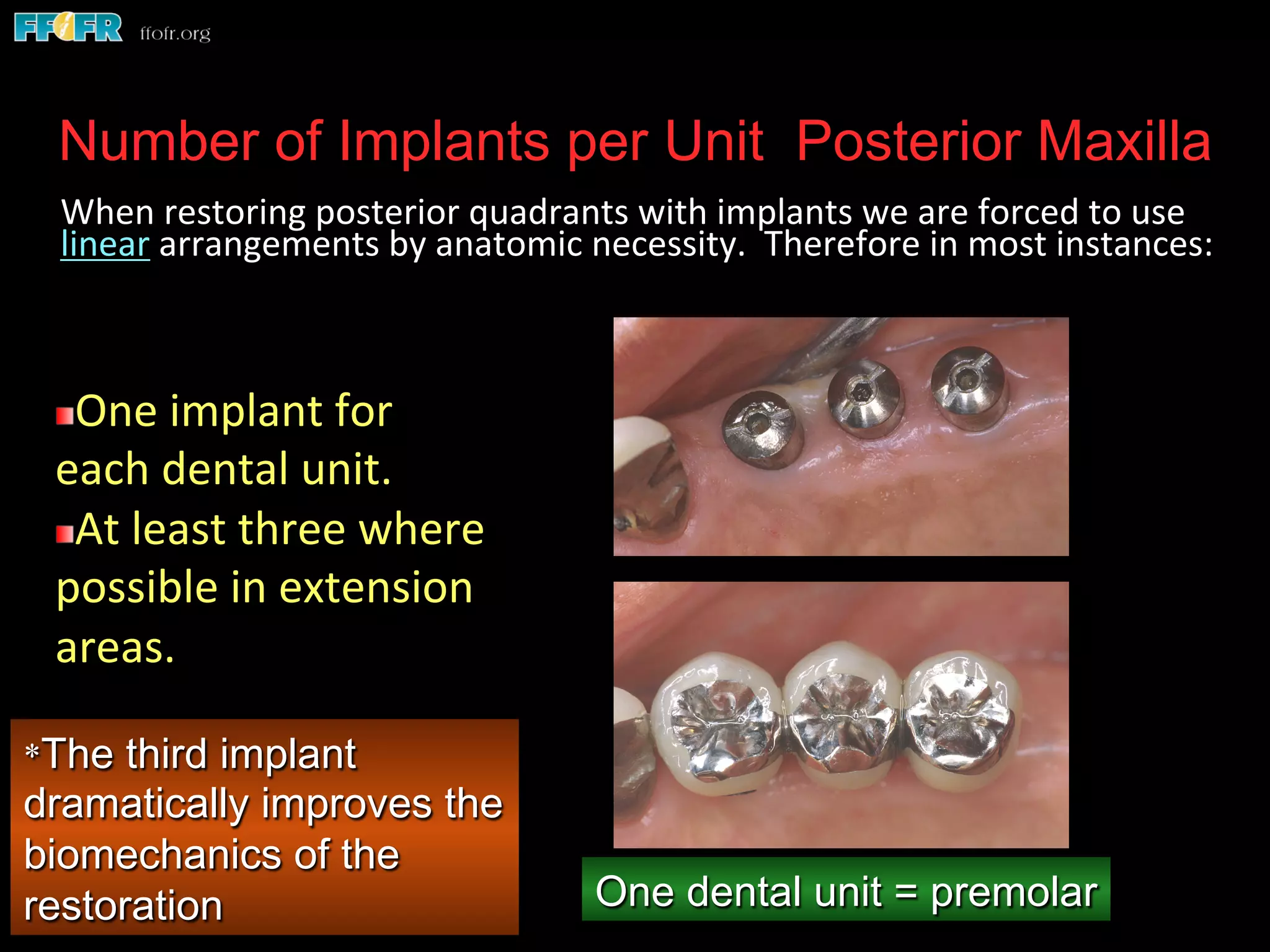 Restoration of posterior quadrants | PDF