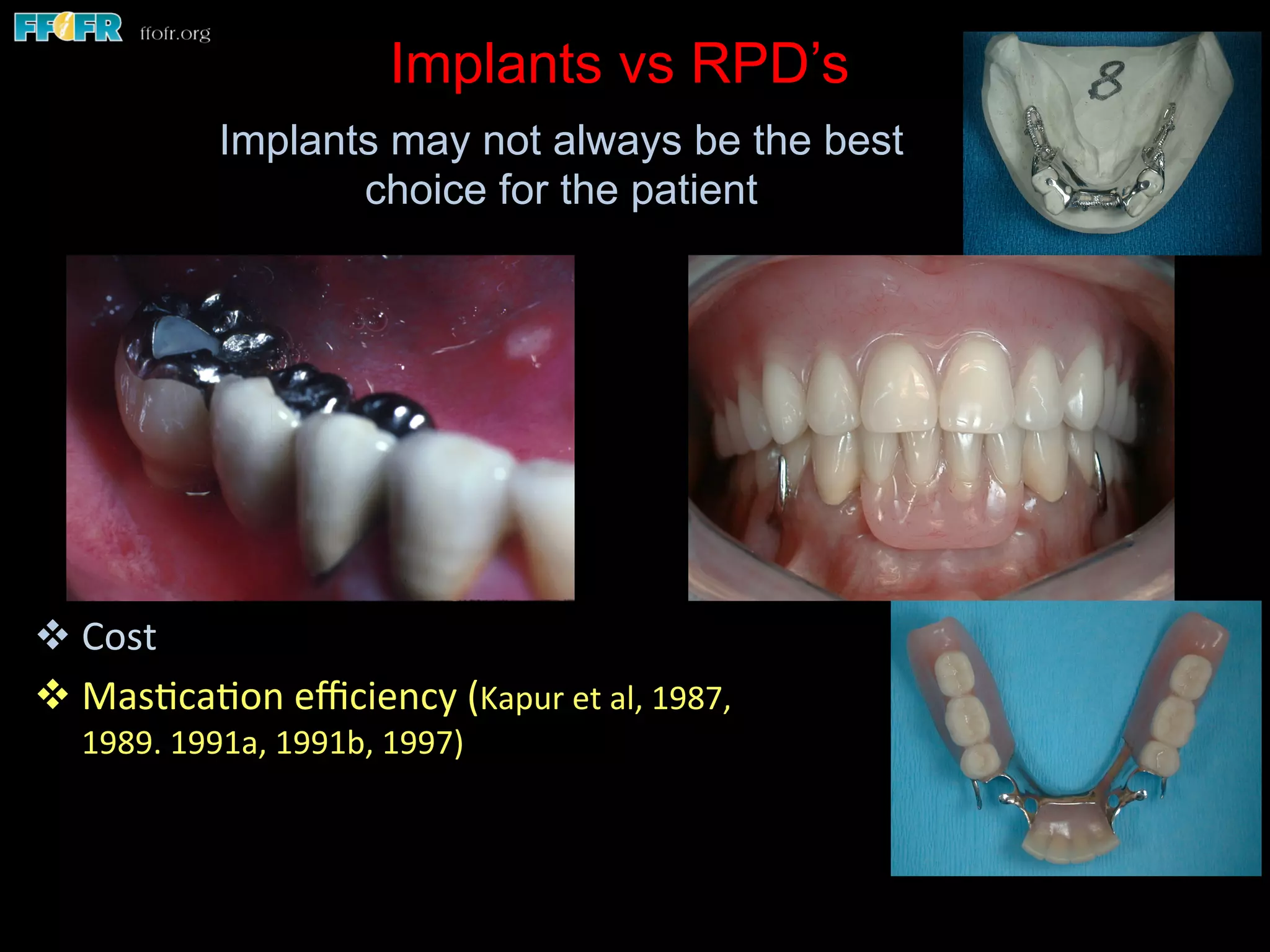 Restoration of posterior quadrants | PPT