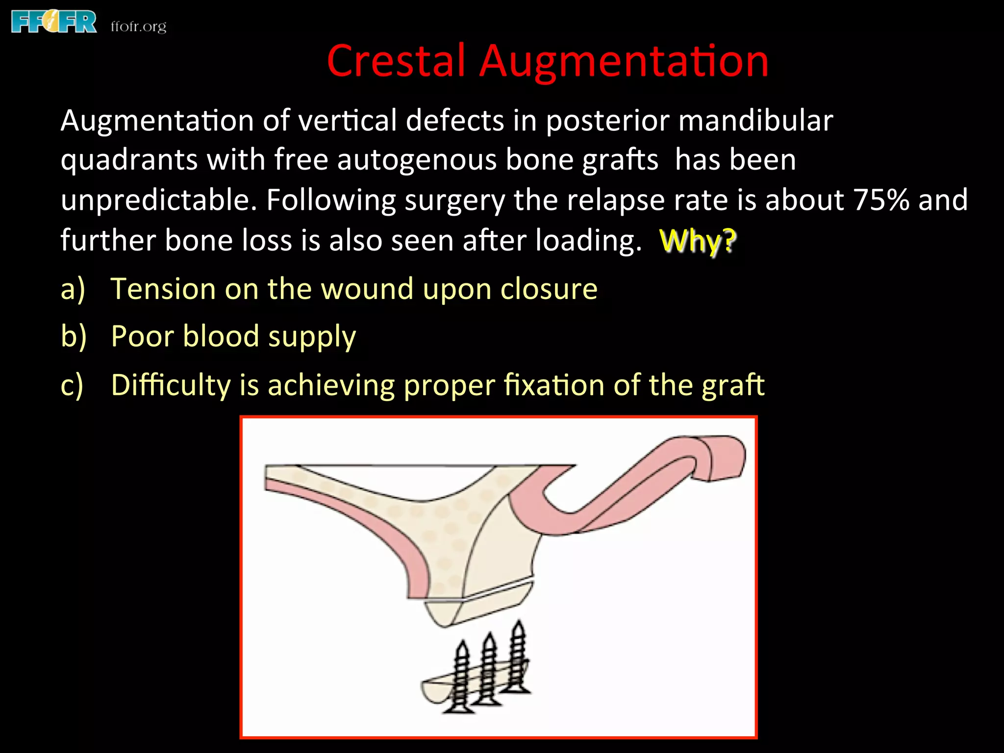 Restoration of posterior quadrants | PDF