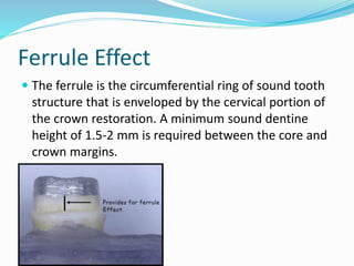 Restoration of the endodontically treated tooth | PPT