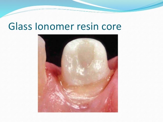 Restoration of the endodontically treated tooth