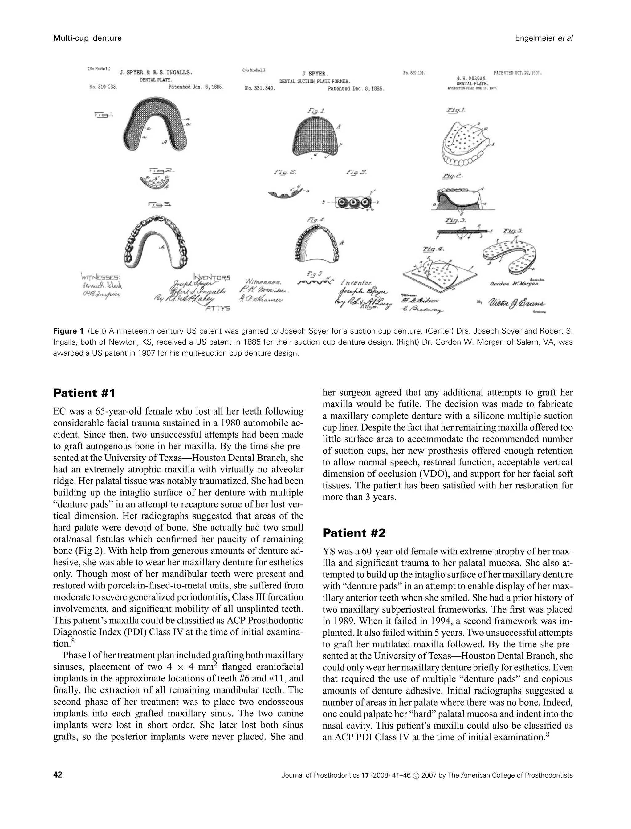 Restoration of the severely compromised maxilla using the multi cup ...
