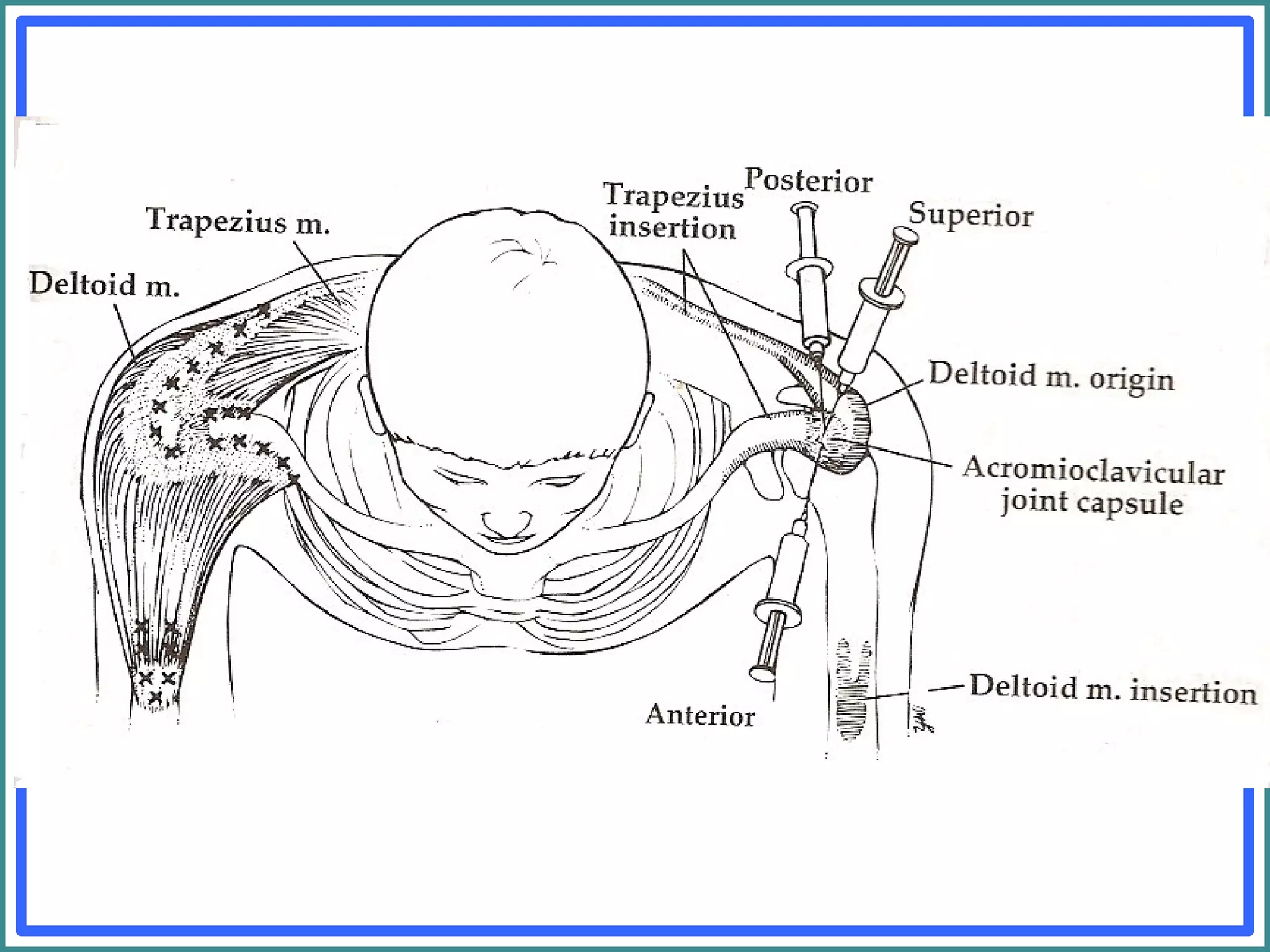 Restorative Invection Therapy.ppt