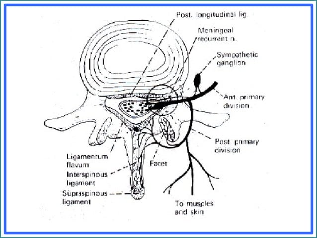 Restorative Invection Therapy.ppt