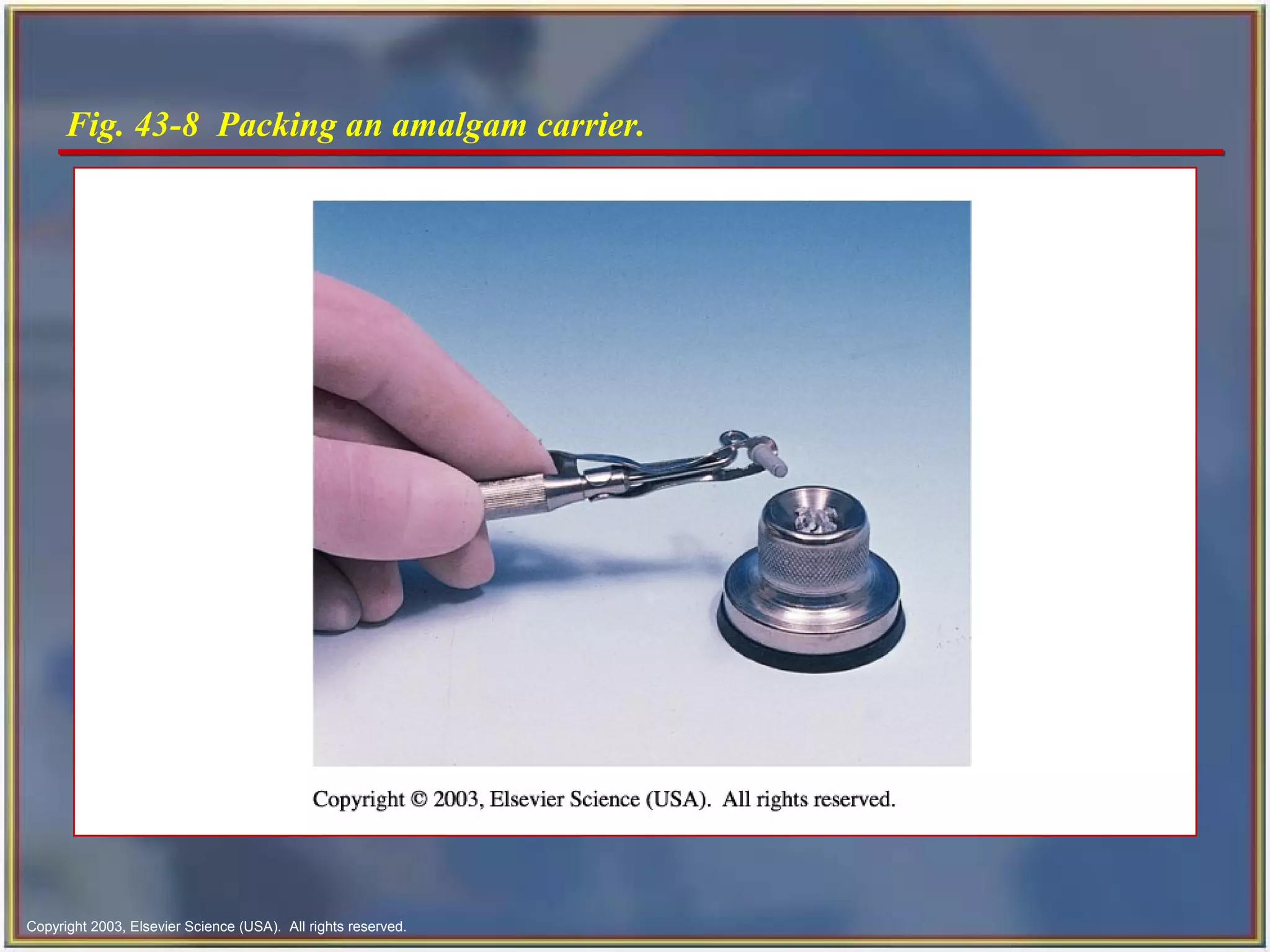 Restorative and esthetic dental materials | PPT