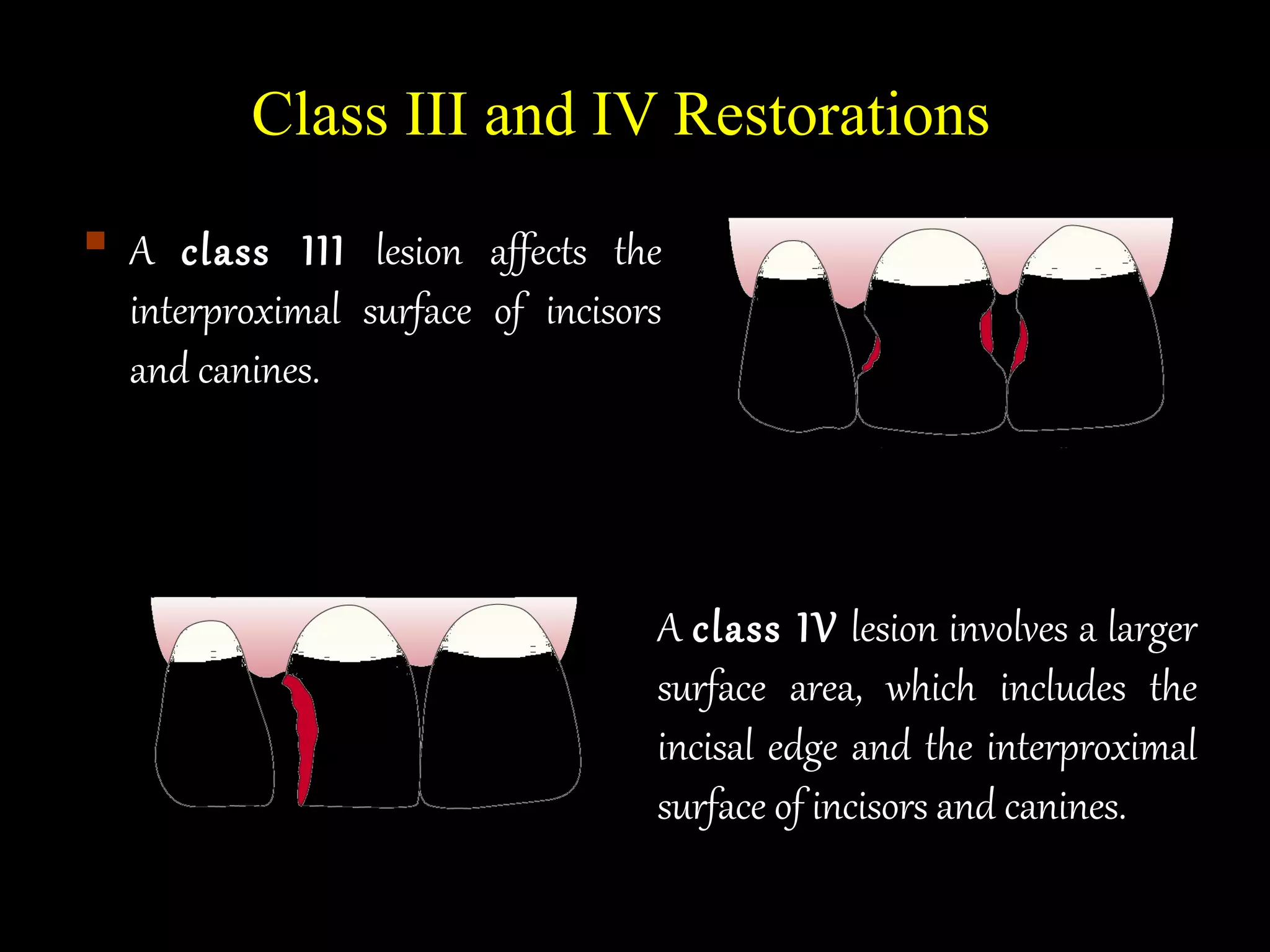 Restorative and esthetic dentistry | PPT