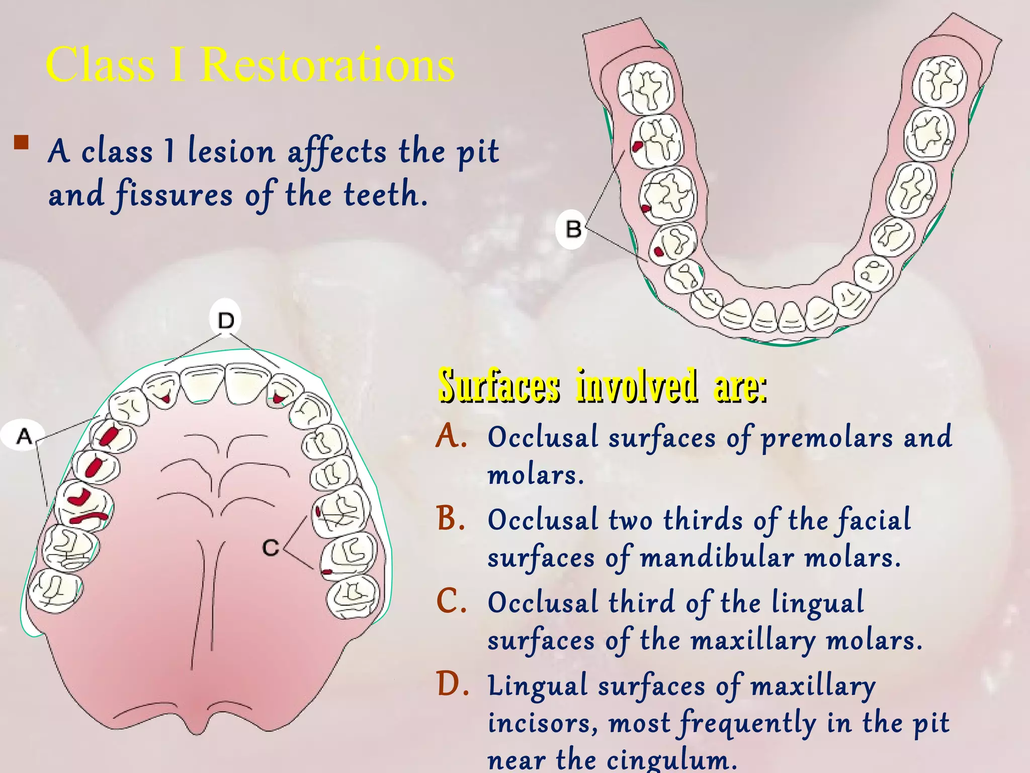 Restorative and esthetic dentistry | PPT