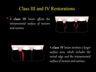 Restorative and esthetic dentistry | PPT