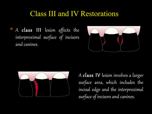 Restorative and esthetic dentistry | PPT