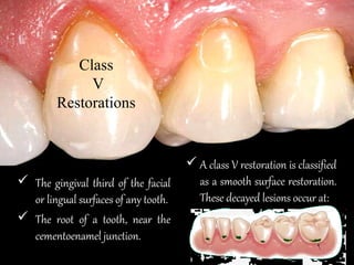 Restorative and esthetic dentistry | PPT
