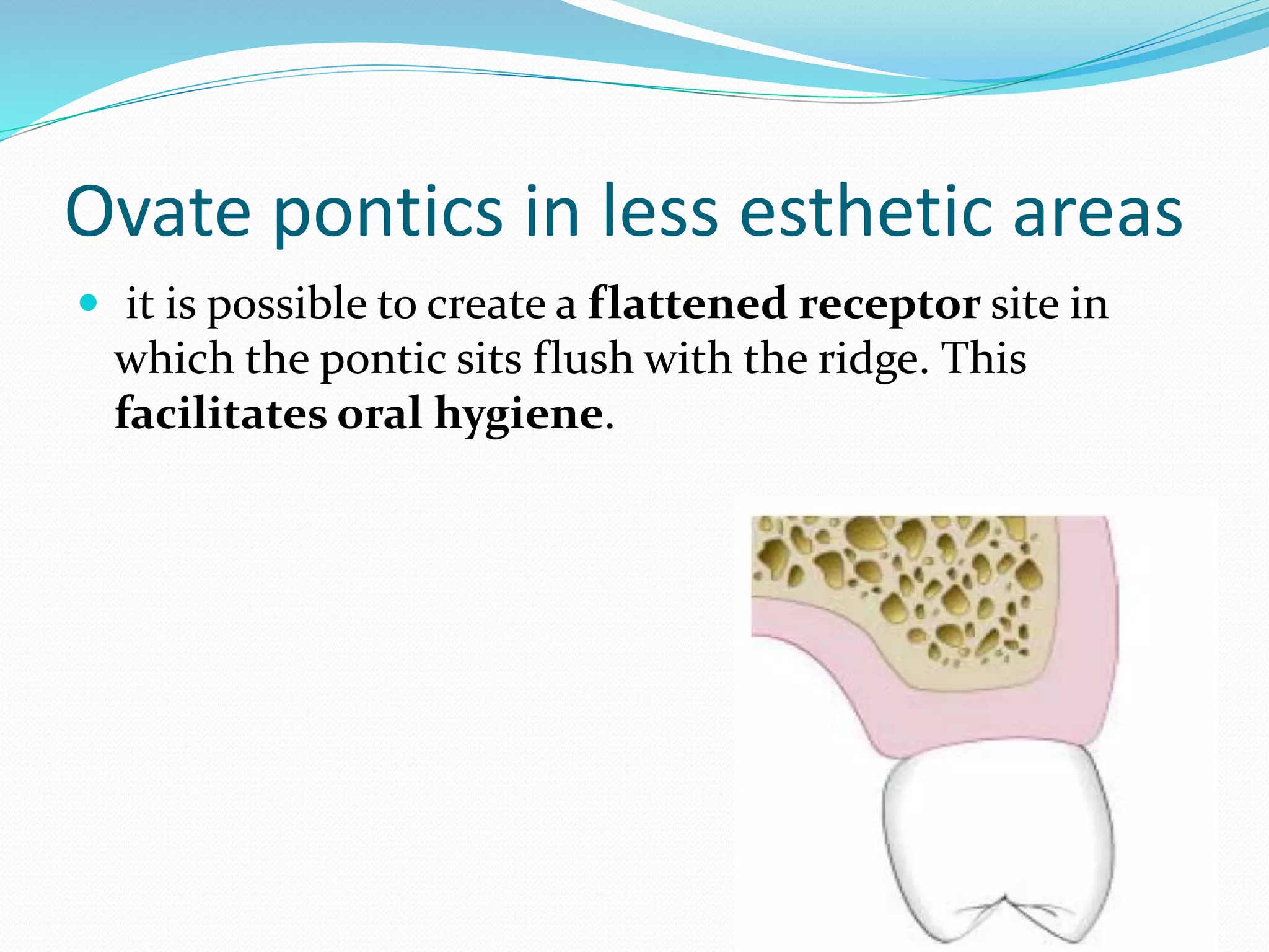 Restorative interrelationships(carranza 2012) | PPTX