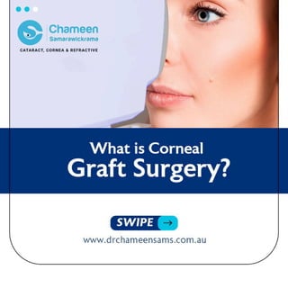 Restore Your Vision with Corneal Graft Surgery in Norwest With Dr ...