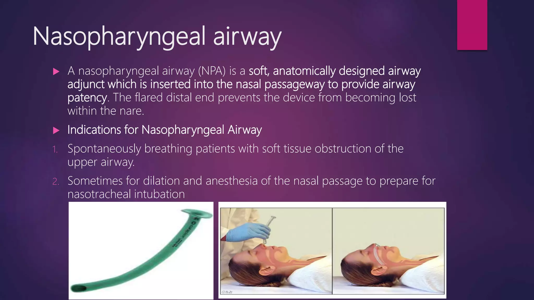 Restoring airway patency | PPT