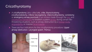 Restoring airway patency | PPT