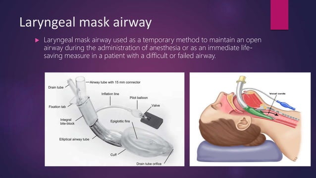 Restoring airway patency | PPT