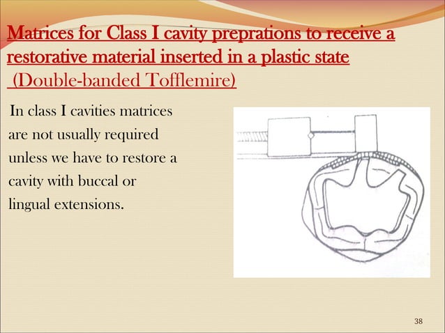 restoring contact and contour classification | PPT