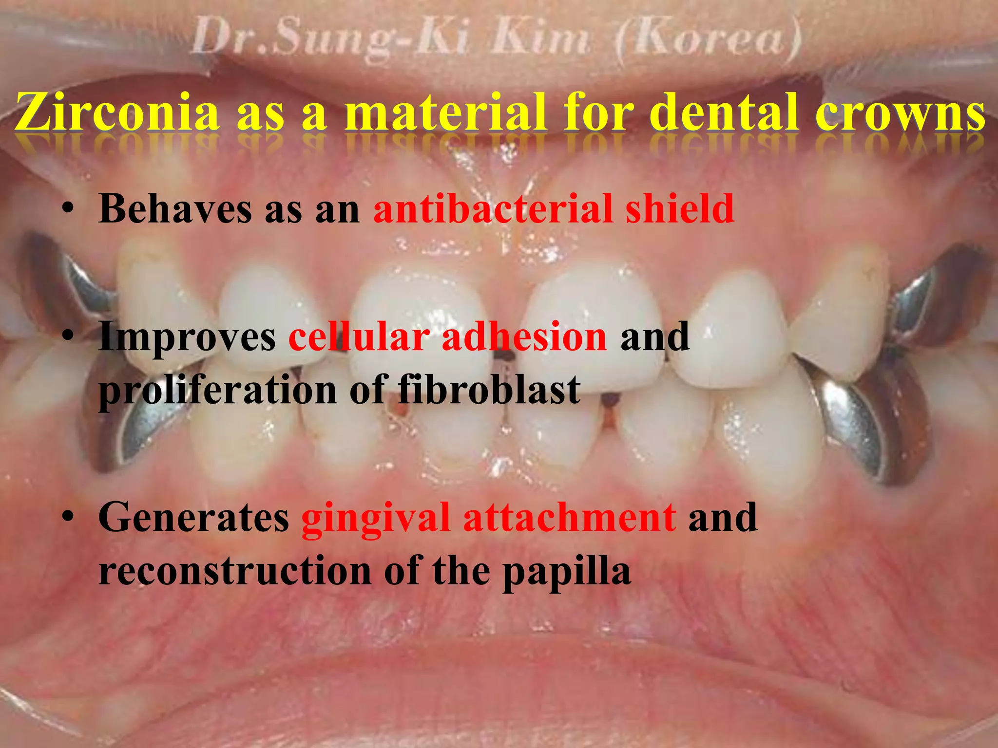 Restoring primary anterior teeth with esthetic crowns | PPTX