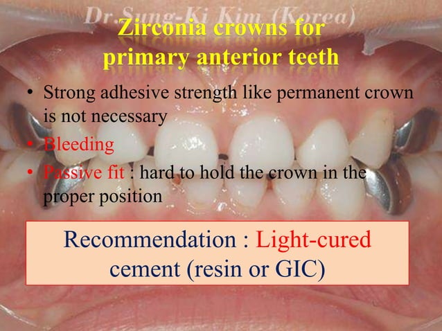 Restoring primary anterior teeth with esthetic crowns | PPTX | Dental ...