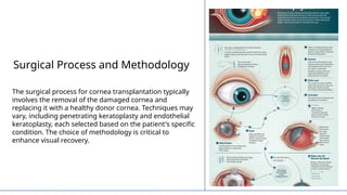 Restoring Vision The Significance and Benefits of Cornea ...
