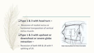 Restrictive strabismus | PPTX
