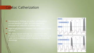 Diagnosis and workup of restrictive cardiomyopathy.pptx