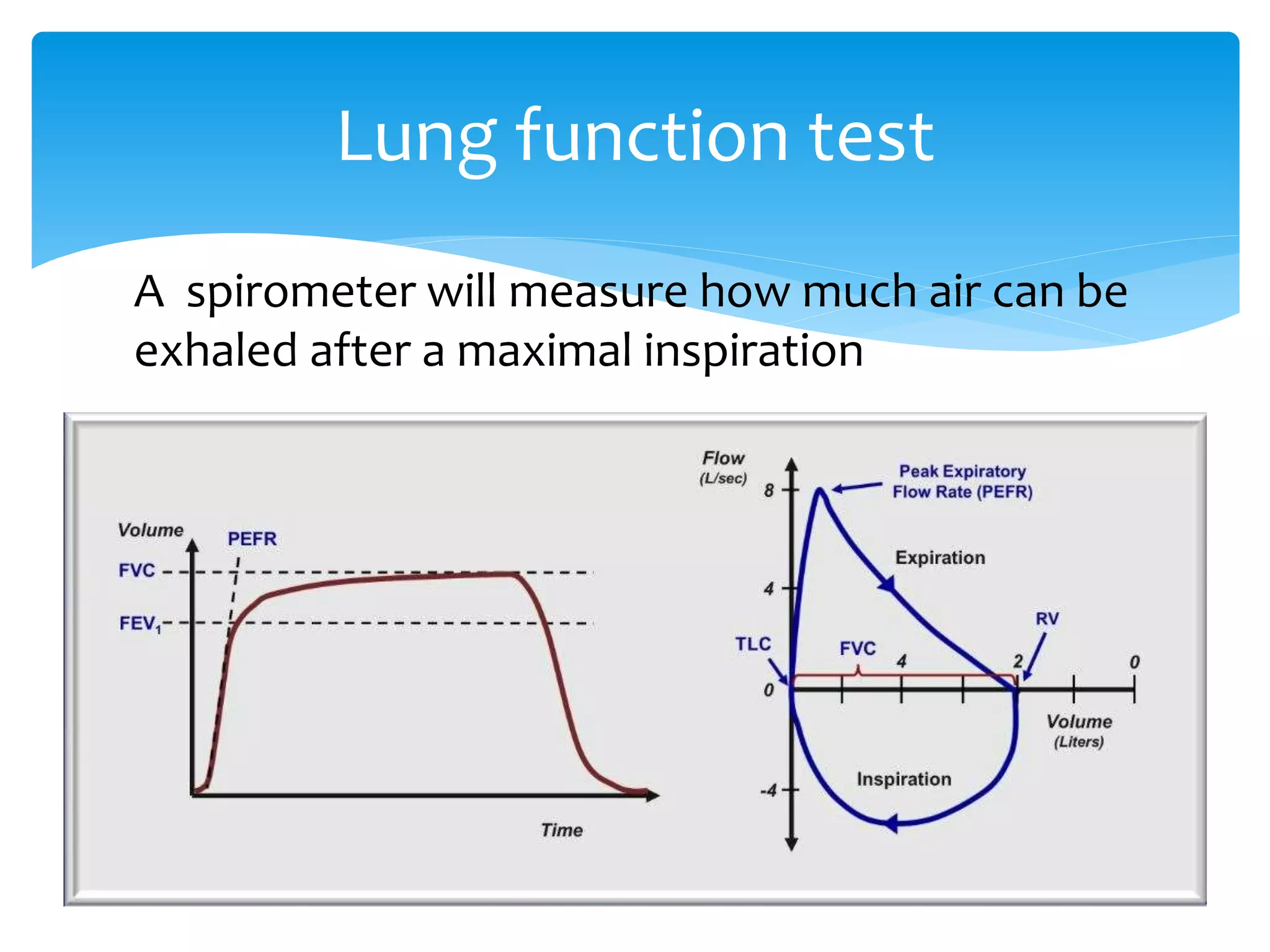 Restrictive lung disease final | PPTX