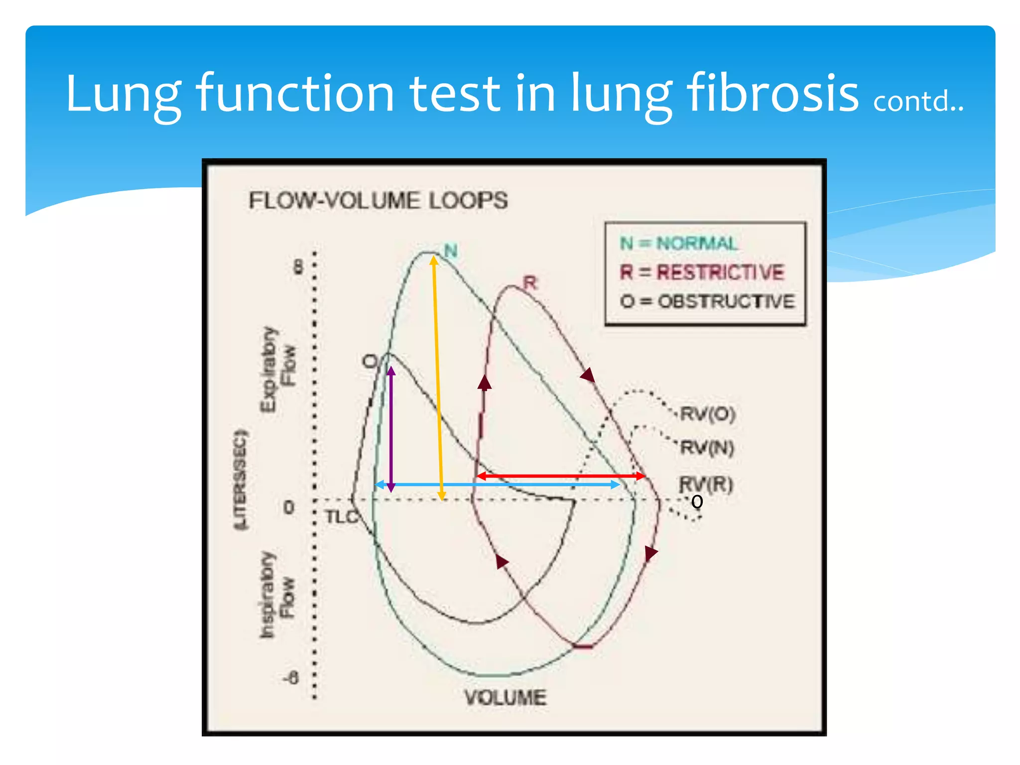 Restrictive lung disease final | PPTX
