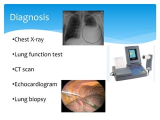 Restrictive lung disease final | PPTX