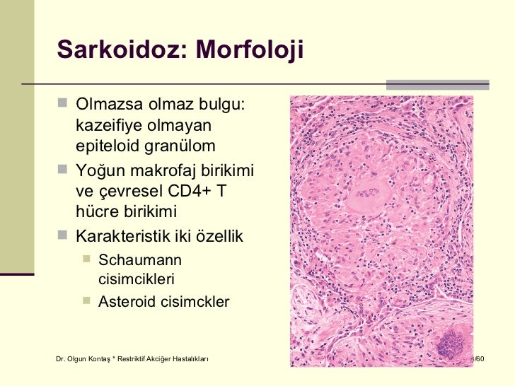 Restriktif akc hst (fazlası için www.tipfakultesi.org )