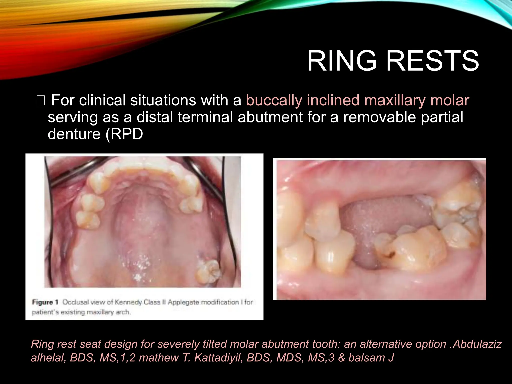 Rests and Rest Seats- prosthodontics. Autosaved pptx | PPTX
