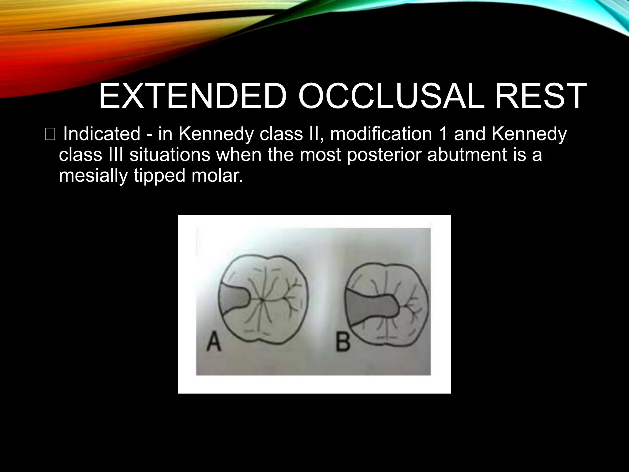 Rests and Rest Seats- prosthodontics. Autosaved pptx | PPTX