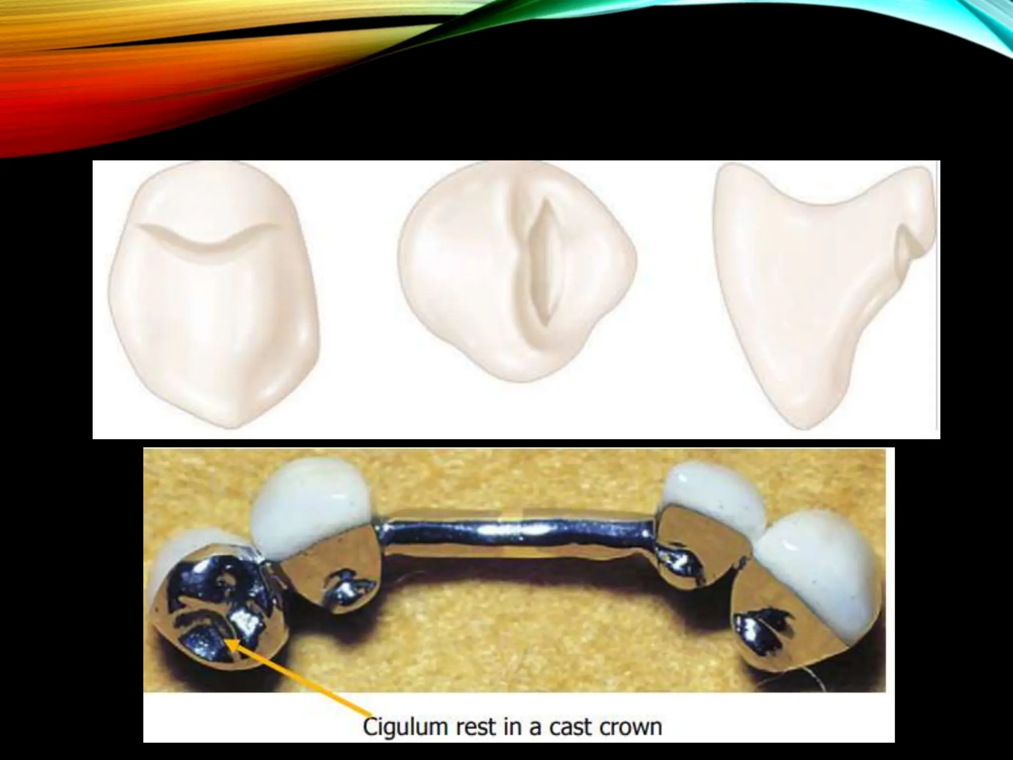 Rests and Rest Seats- prosthodontics. Autosaved pptx | PPTX