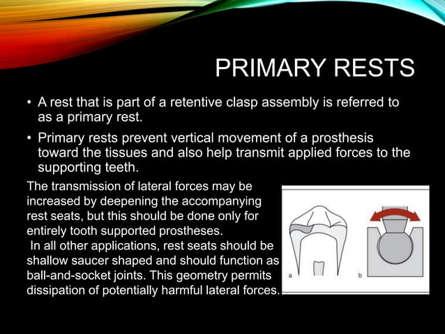 Rests and Rest Seats- prosthodontics. Autosaved pptx | PPTX